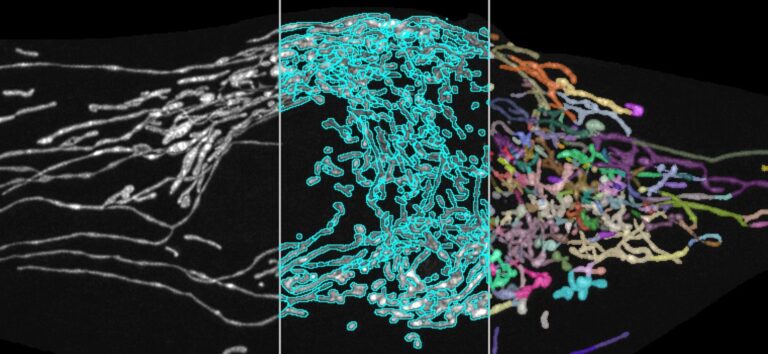Image processing & analysis with ImageJ/Fiji – OOA – Oncology Graduate School Amsterdam
